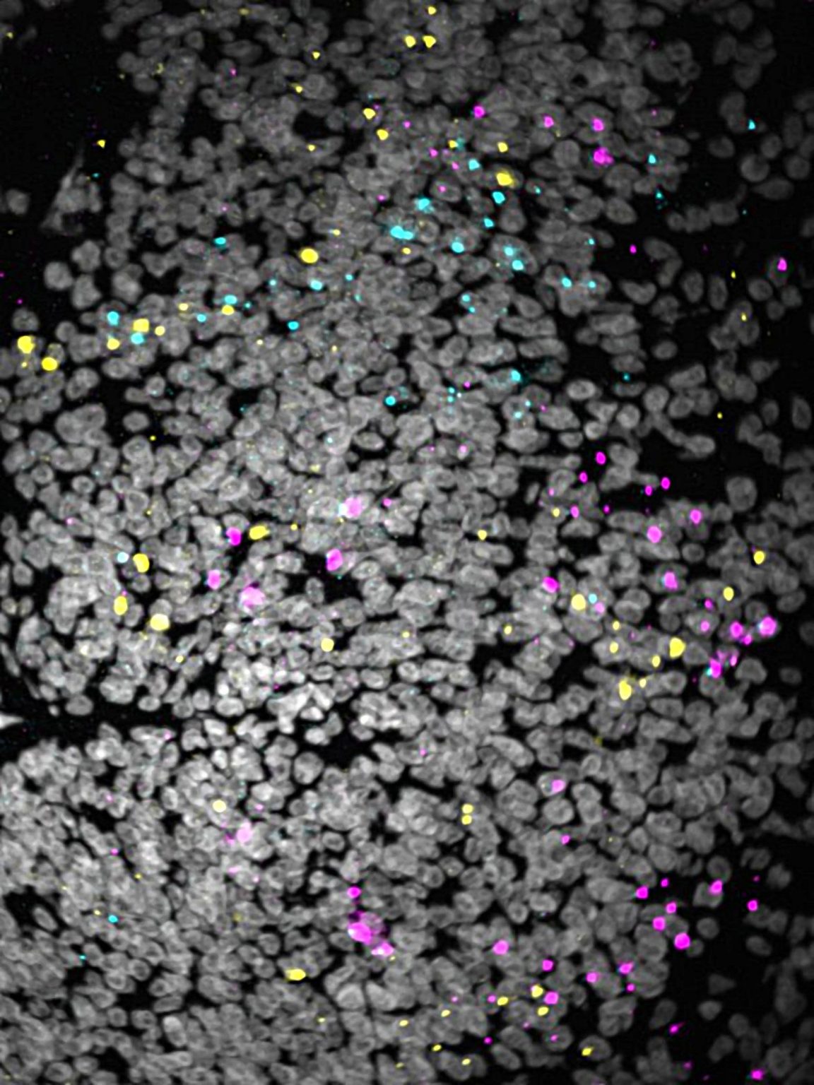 Visualizing DNA Labels in Cells and Tissues – Tianqiao & Chrissy Chen ...