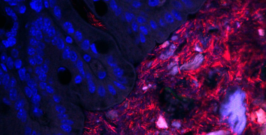 Mapping Bacterial Neighborhoods in the Gut – Tianqiao & Chrissy Chen ...