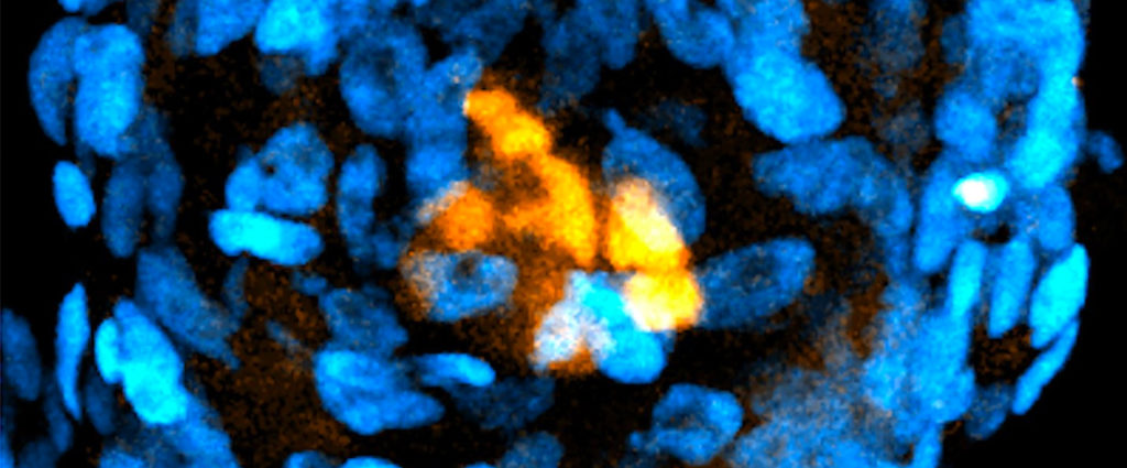 Researchers Build Embryo-Like Structures from Human Stem Cells ...