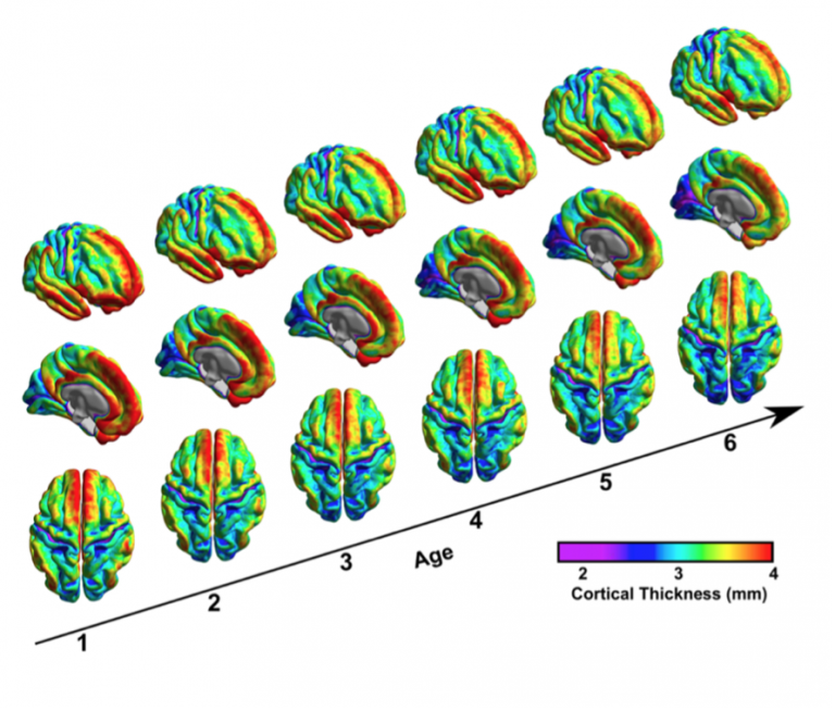 Chinese Scientists Draw Growth Curve of Golden Phase of Brain ...
