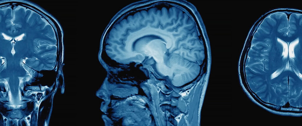 China’s First Brain Science Documentary Goes Viral, Highlighting TCCI’s ...