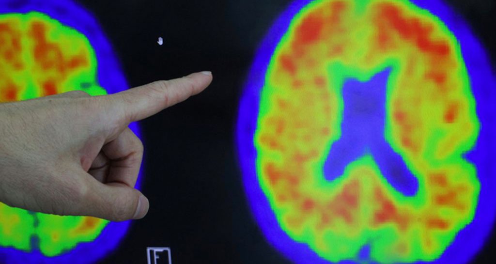 Tianqiao & Chrissy Chen Institute Is Hiring AI Scientists Globally ...