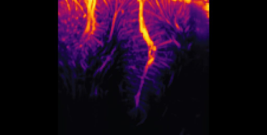 Ultrasound Enables Less-Invasive Brain–Machine Interfaces – Tianqiao & Chrissy Chen Institute ...