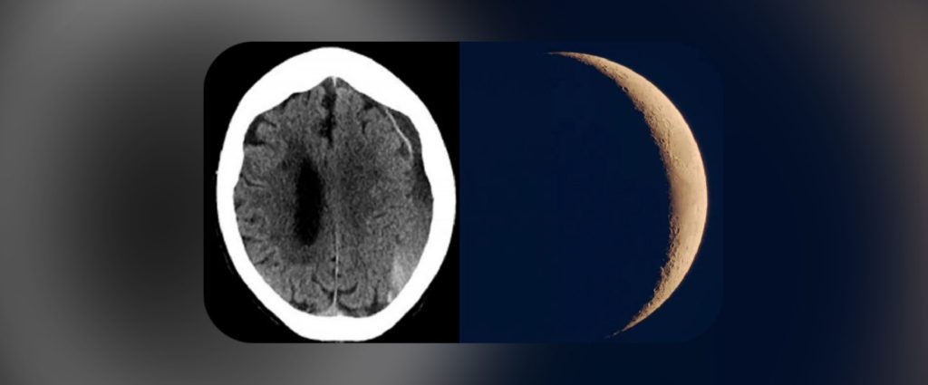 On behalf of all investigators, Ying Mao presents the results of the ...